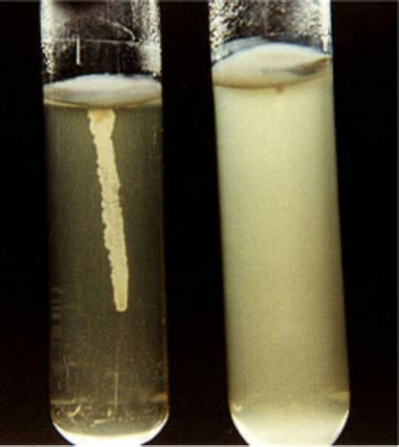 Demolab 3 Microbiological Diagnostic Algorithm Flashcards Quizlet