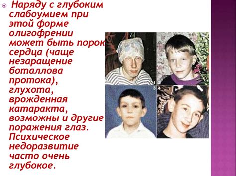 Рубеолярная олигофрения - презентация онлайн