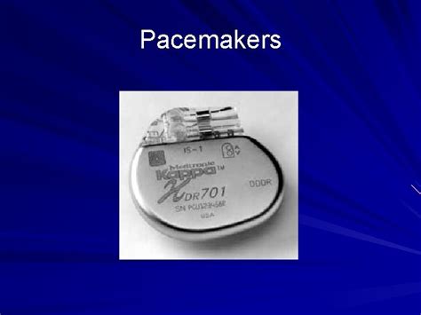 Pacemakers Outline 1 Pacemaker Codes 2 Pacemaker Configurations