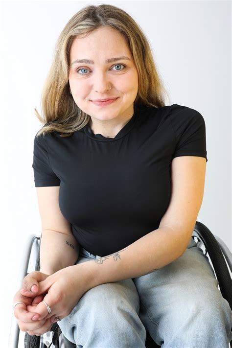 Maya D Zebedee Talent Models With Disabilities Visible Differences