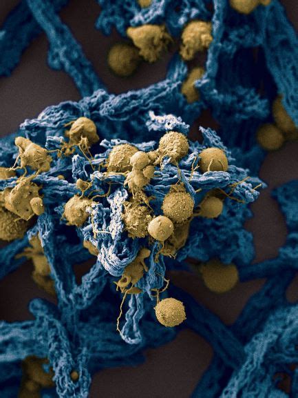 Expansion Of Antigen Specific T Cells Using Programmable Biomaterial