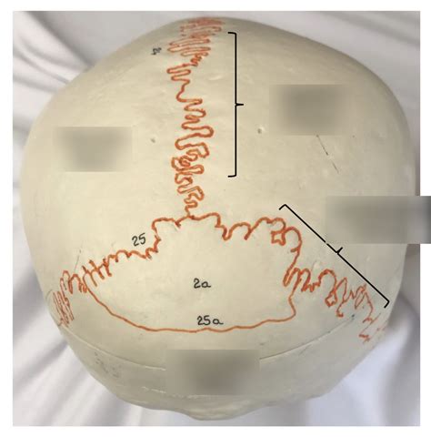 Bio 307 Axial Skeleton Diagram 3 Diagram Quizlet