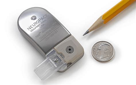 Epilepsy Uva Develops Imaging Approach To Help Stop Epilepsy Seizures