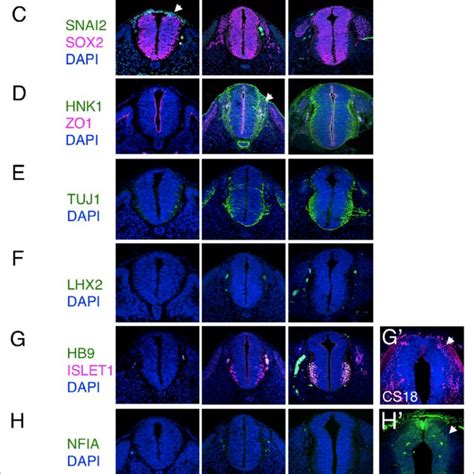 Characterization Of Neural Progenitors And Neuronal Subtypes In Human Download Scientific