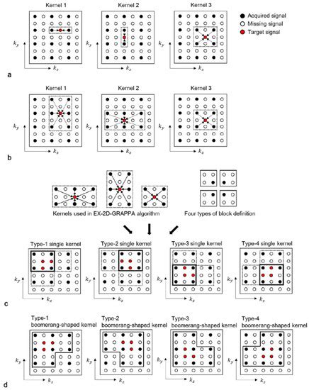 Sensors Free Full Text A 2d Grappa Algorithm With A Boomerang