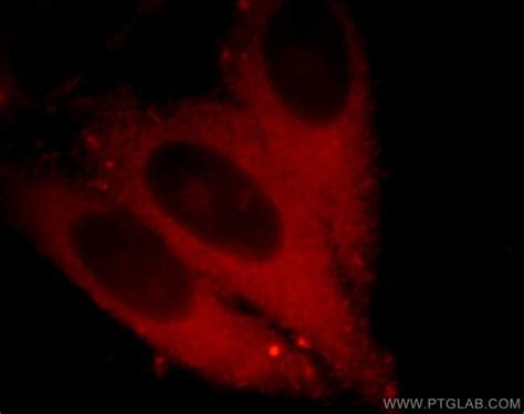 Synaptopodin Rabbit Anti Human Mouse Rat Polyclonal Proteintech 150
