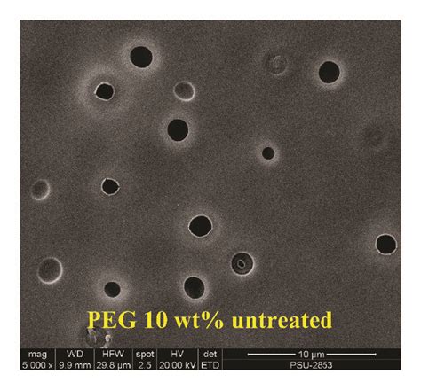 Sem Micrographs Of Top Skin Layers Of Psf Peg 10 Wt Membranes