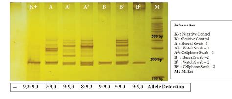 Figure 1 From The Use Of Touch DNA Analysis In Forensic Identification Focusing On Short Tandem