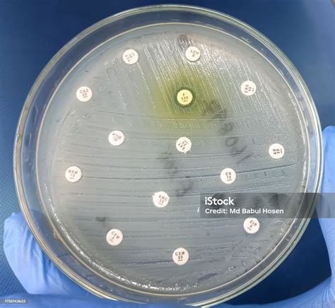 All Antibiotic Are Resistance Antimicrobial Susceptibility Testing In