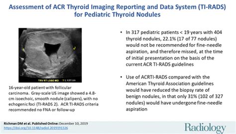 Assessment Of American College Of Radiology Thyroid Imaging Reporting