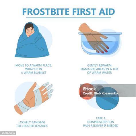 Frostbite Infographic First Aid Instructions Stock Illustration