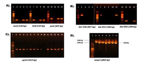 Detection Of Virulence Genes Extended Spectrum β Lactamase Esbl