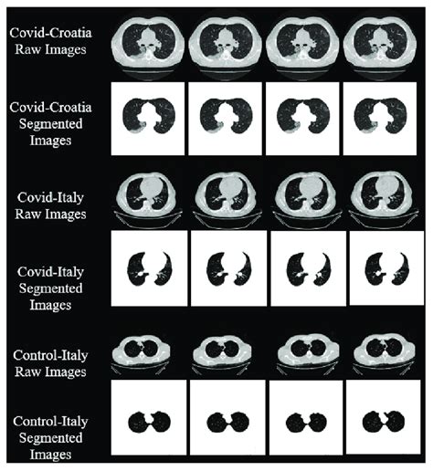 raw images and corresponding segmented images after resnet unet