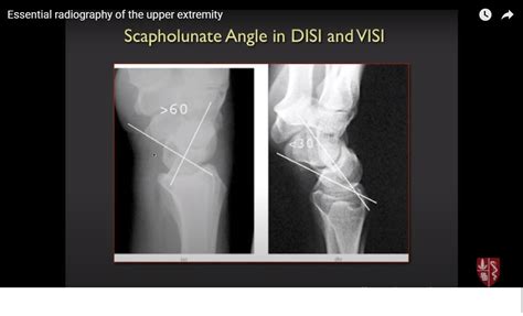 Essential Radiography Of The Upper Extremity —