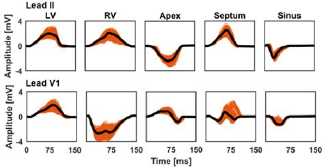 The Simulated Qrs Complexes For All 262 Cardiac Shape Models Orange Download Scientific