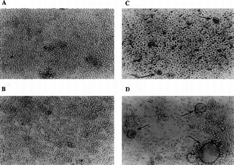 Virus Mediated Syncytium Formation By M And Dual Tropic Hiv 1 Strains