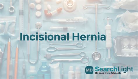 Incisional Hernia Md Searchlight