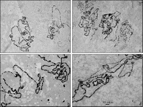 Polytene Chromosomes Of Drosophila Melanogaster After Oral Download Scientific Diagram
