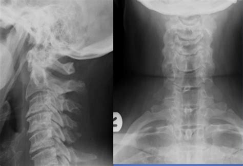 302 Clinical Imaging Lab 3 Flashcards Quizlet