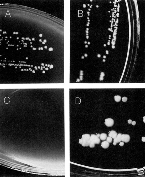 Growth Of Corynebacterium Group Anf 1 Strains On 5 Sheep Blood Agar A
