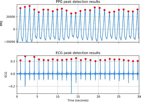 The Peak Detection Results For A 30 Seconds Segment Of Ppg And Ecg