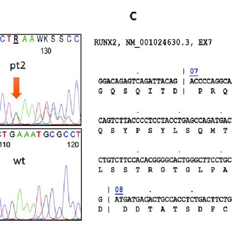 Reverse Gdna Sequences Of The Two Novel Runx2 Mutations In Ccd Patient Download Scientific