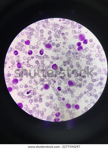 Human White Blood Cells Under Microscope Stock Photo Shutterstock