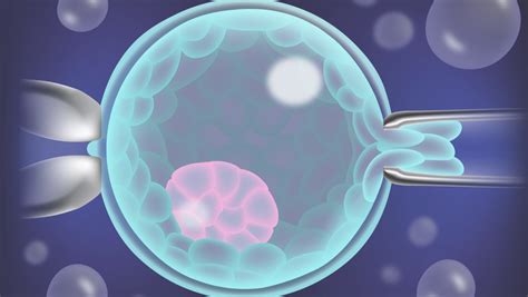 PGT And Embryo Biopsy Is It Right For You Next Fertility Nordic