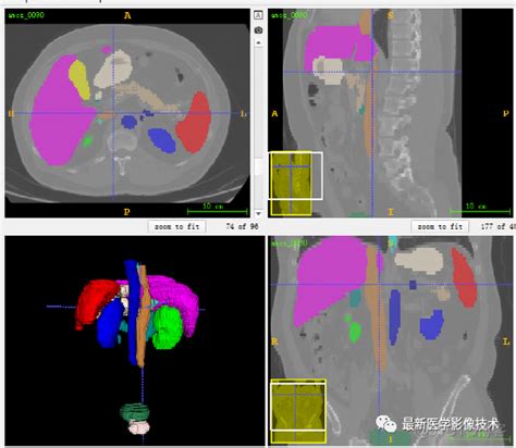 Amos2022——腹部多器官分割挑战赛12697048的技术博客51cto博客