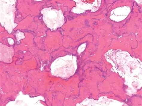 Bone 2 Non Neoplastic Flashcards Quizlet