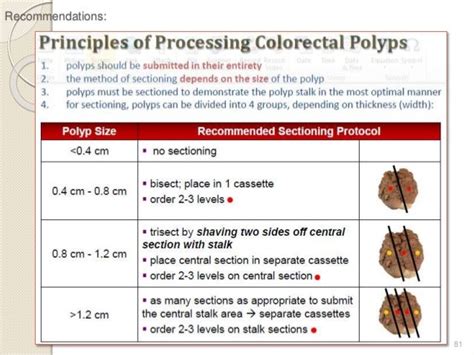 Grading Colon Polyps