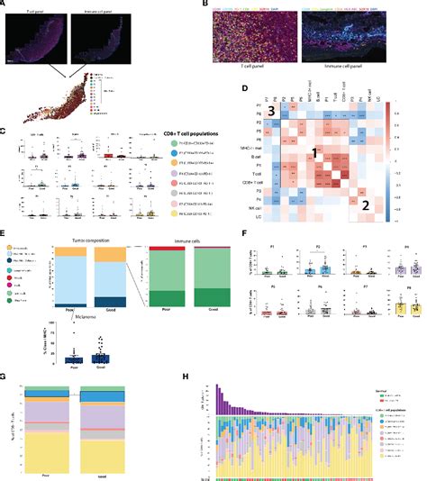 Table 1 From Detailed Spatial Immunophenotyping Of Primary Melanomas