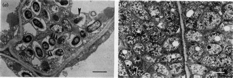 Transmission Electron Micrographs Of Clare Subterranean Clover Nodules Download Scientific