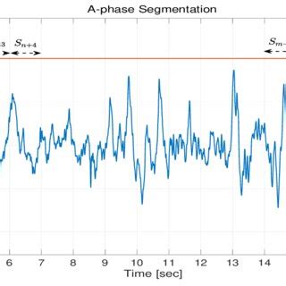 Example Of A Segment Of The EEG Signal During The Occurrence Of An Download Scientific Diagram