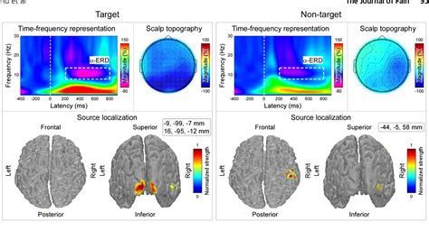 Figure 1 From Functional Features Of Nociceptive Induced Suppression Of Alpha Band