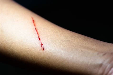 Understanding Common Assault Charges In Australia