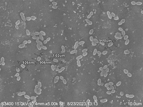 The Scanning Electron Microscope Image Of Lactococcus Sp Download Scientific Diagram