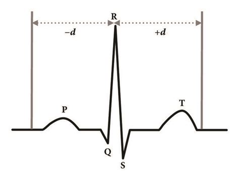 Example Of Fiducial Segmentation Download Scientific Diagram