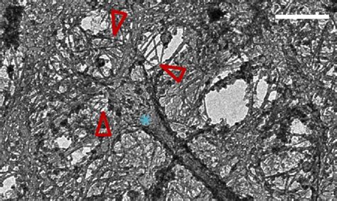 Intracellular And Extracellular Forces Drive Primary Cilia Movement