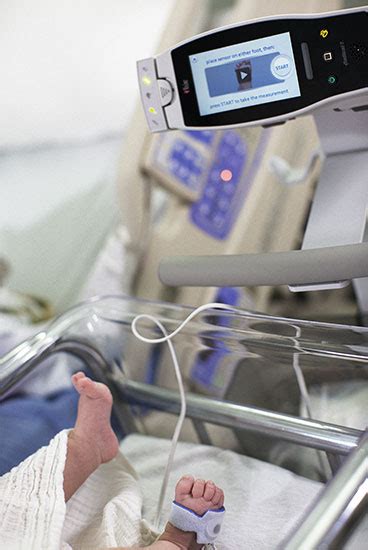 Masimo Cchd Screening