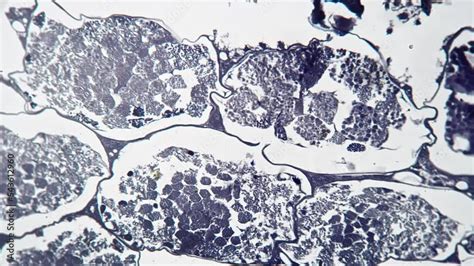 Meiosis Of Grasshopper In Section Under Microscope Magnified In 200 Times Against Bright Field Meiosis Of Grasshopper In Section Under Microscope Magnified In 200 Times Against Bright Field