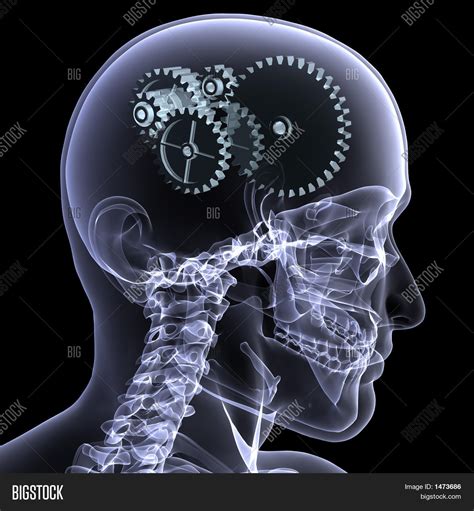Skeleton X Ray Image And Photo Free Trial Bigstock