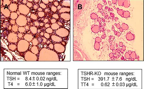 Normal Thyroid