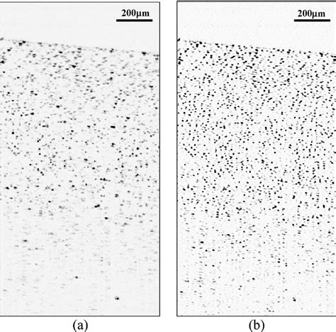 application of the dynamic richardson lucy algorithm on a tissue
