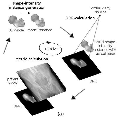 A 2d 3d Registration Scheme And B Two Exemplary Qualitative Results