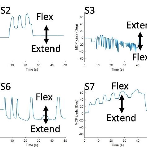 Exhibits Movements Of The Mcp Joints Of Individual Participants And The Download Scientific
