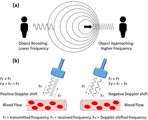 The Doppler Effect And How It Is Used To Measure Flow A A Diagram Download Scientific
