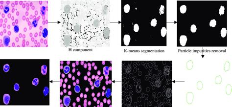 Flowchart Of The Proposed Segmentation Scheme Download Scientific
