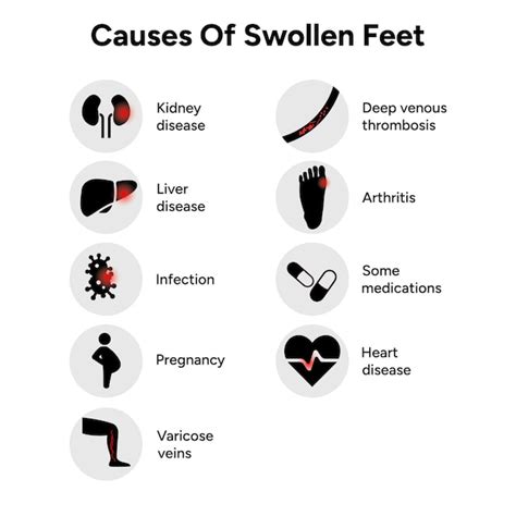 Causes Of Swollen Feet Premium Vector