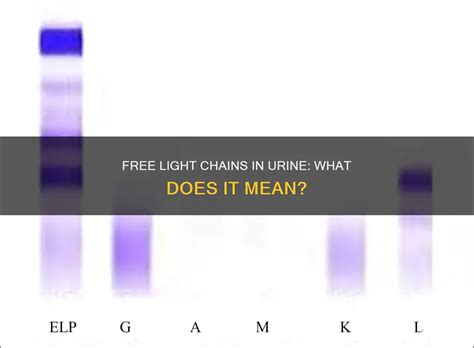 Free Light Chains In Urine What Does It Mean MedShun